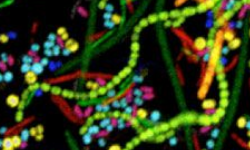 16S/18S FISH荧光探针设计及检测服务 常见问题及解决方案 - 微基生物